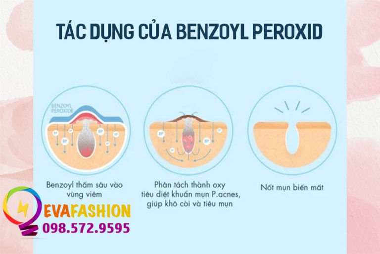 Benzoyl Peroxid là gì? Lợi và hại khi sử dụng BP để điều trị mụn