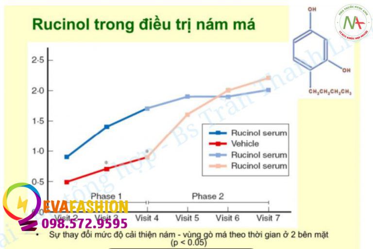 Các loại thuốc bôi tại chỗ điều trị nám má hiệu quả